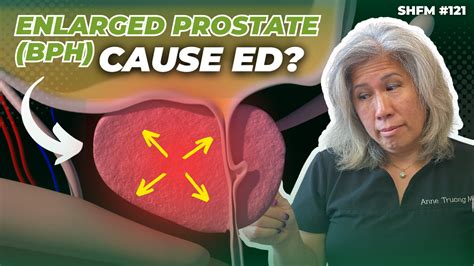Does An Enlarged Prostate Bph Cause Erectile Dysfunction