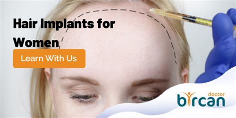 Hair Implants For Women Dr Gökhan Bircan