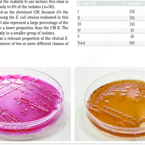 Pdf Colonial Morphology Of Escherichia Coli Impact Of Detection In