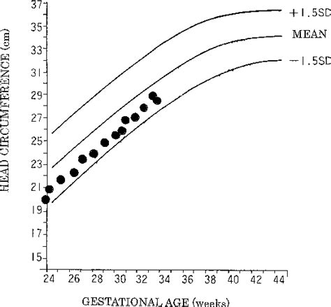 Figure 1 From Report On Experiments And Clinical Cases ― Massive