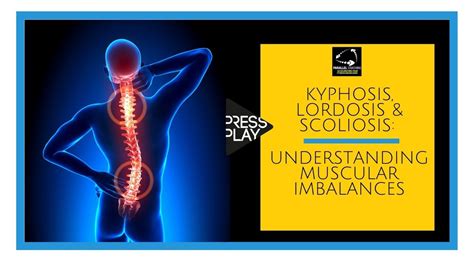 Lordosis Vs Kyphosis