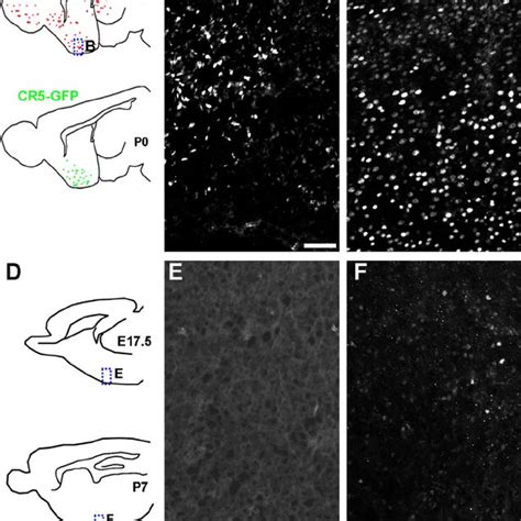 Sox5 Expression Is In The Neonatal Ventral Forebrain Sagittal Sections