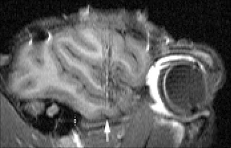 Mirror Image Confusion In Single Neurons Of The Macaque Inferotemporal