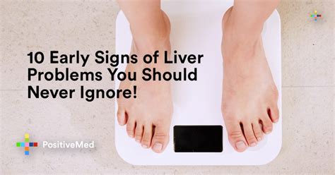 10 Early Signs Of Liver Problems You Should Never Ignore