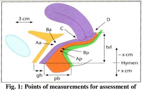 Association Between The Standardized Pelvic Organ Prolapse