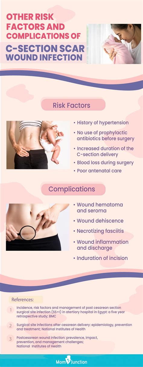 C Section Scar Infection Causes Types Signs And Treatment