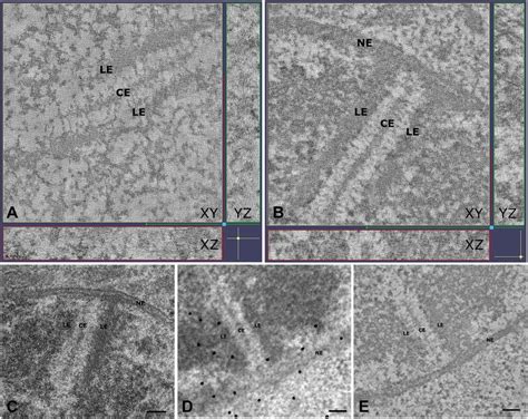 Electron Tomography Et Providing High 3d Resolution Of The