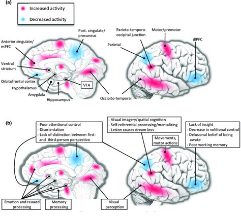 A Functional Neuroanatomy Of Rem Sleep Brain Regions More Activated