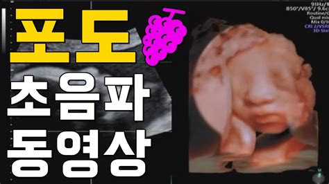 임신 초기 중기 말기 임신 확인 후 출산 전까지 초음파 영상 모음 Youtube