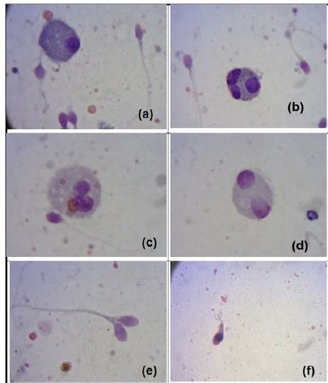 Immature Germ Cells And Sperm Morphology In The Exposed Group A