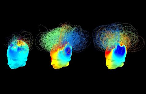New Technique Helps Find Hidden Consciousness In Coma Patients