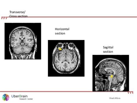 Basics Of Functional Neuroanatomy Basic Function