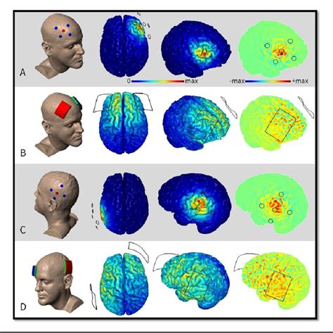 تحریک الکتریکی مغز Tdcs چیست؟ 1ارگونومیست