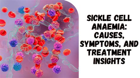 Sickle Cell Anaemia Causes Symptoms And Treatment Insights