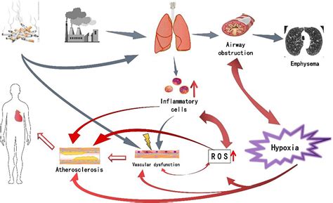 Copd Pathogenesis