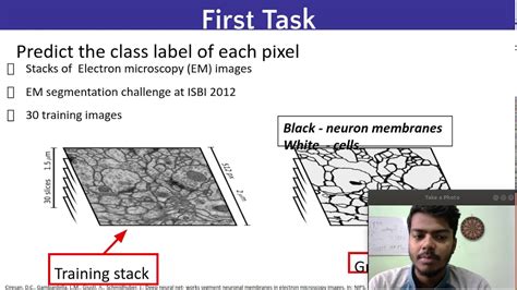 u net convolutional networks for biomedical image segmentation now
