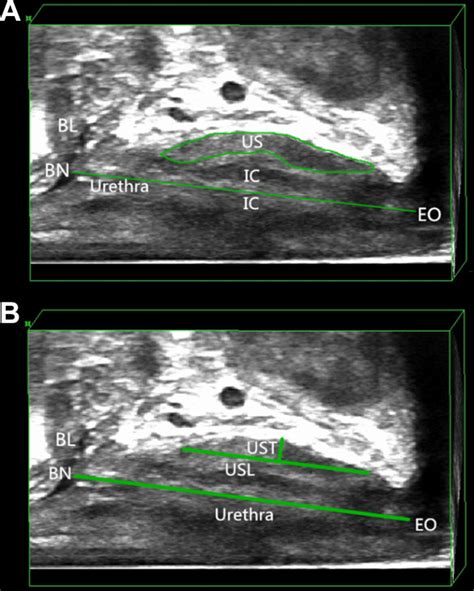 Repeatability Of Female Midurethral Measurement Using High‐frequency 3