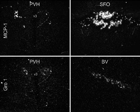 Lps Induced Expression Of Additional Chemokines Mcp 1 And Gro 1 Other