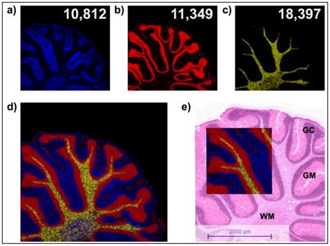 High Spatial Resolution Imaging Mass Spectrometry And Classical