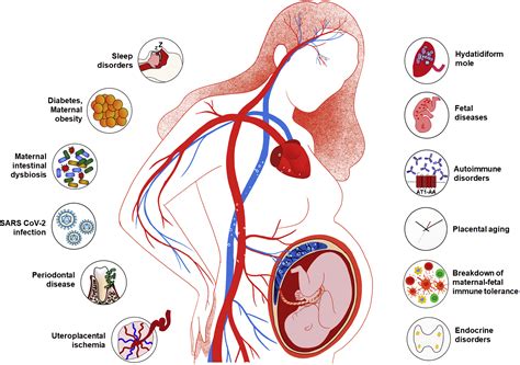 The Etiology Of Preeclampsia American Journal Of Obstetrics And Gynecology