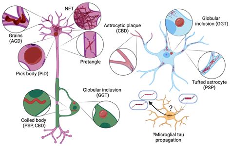 Ijms Free Full Text Tau As A Biomarker Of Neurodegeneration