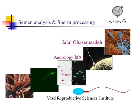 Ppt Semen Analysis And Sperm Processing Powerpoint Presentation Id