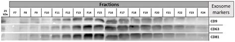 Nutrients Free Full Text Human Breast Milk Micrornas Potential