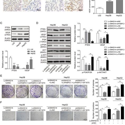 Snhg14 Pabpc1 Promotes Cell Proliferation And Angiogenesis Via
