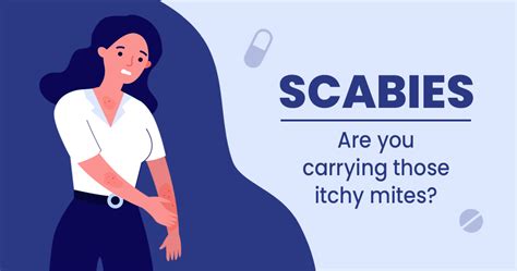Scabies Symptoms And Treatment Star Health