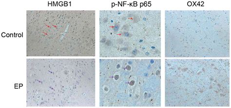 Hmgb1 Mediates Microglia Activation Via The Tlr4 Nf κb Pathway In