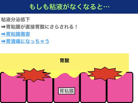 Nsaidsで胃潰瘍になる仕組み！薬の機序をわかりやすく解説！
