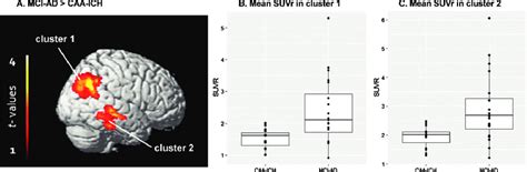 Groups Compared Using A Voxel Wise Approach A Statistical Parametric