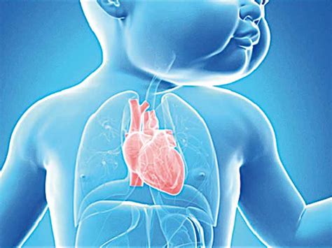 Promueven La Prevención Temprana De Las Cardiopatías Congénitas Radio
