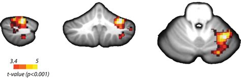 Figures And Data In Human Premotor Areas Parse Sequences Into Their