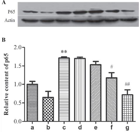 Effect Of Escin On The Nuclear Factor κb Nf κb P65 Protein Expression