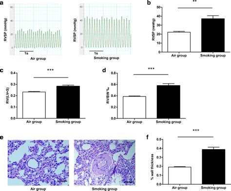 Role Of Rasef Hypermethylation In Cigarette Smoke Induced Pulmonary