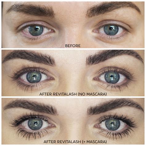 Revitalash Advanced Lash Growth Serum Full Review With Before And
