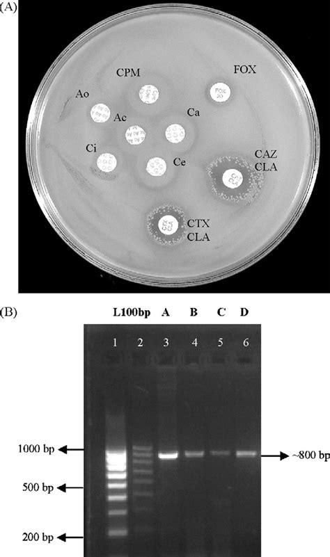 Demonstration Of Extended Spectrum Lactamase Esbl From Acinetobacter