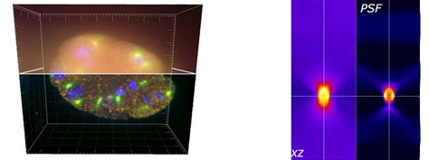 3d deconvolution microscopy