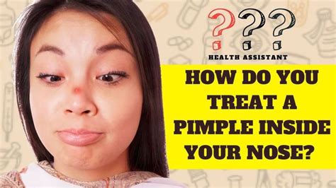Inside Pimples