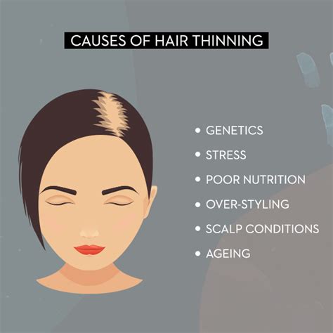 Hair Regrowth Treatment