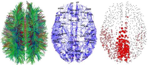 brain connections resting state fmri functional