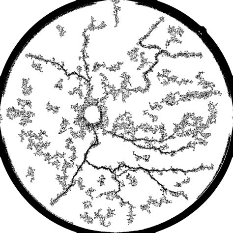 python how to improve vessel segmentation such that