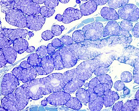 Mucous Gland Photograph By Jose Calvo Science Photo Library Fine