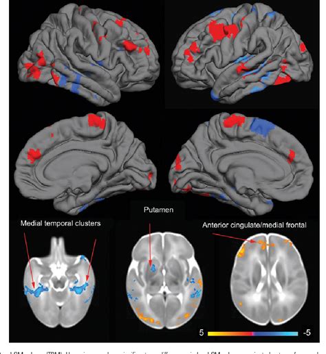 Figure 1 From Impact Of Sex And Gonadal Steroids On Neonatal Brain