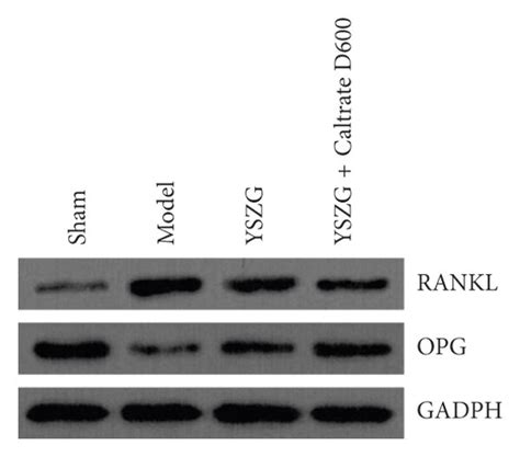 Yszg Decoction Promotes The Bone Formation And Resorption In Pmo Rats