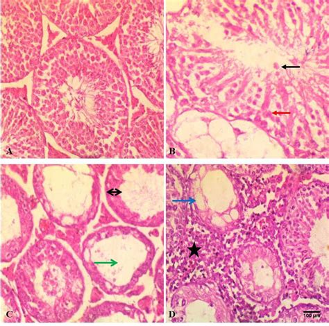 Representative Photomicrographs Of Histoarchitecture Of Testicular