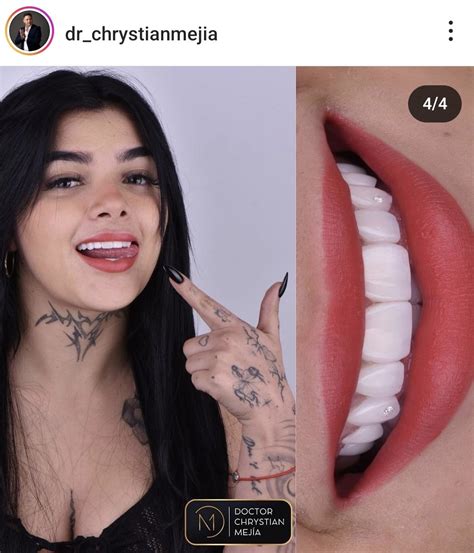 Novia Dentista 🦷💍🦷 On Twitter El Dentista De Las Estrellas 🌟 Que Tal