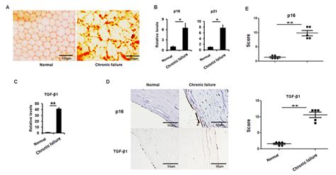 Tgf β Induces Corneal Endothelial Senescence Via Increase Of