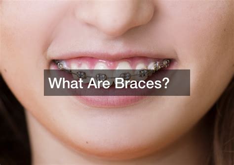 Invisible Braces Vs Normal Braces The Pros And Cons Healthy Huntington
